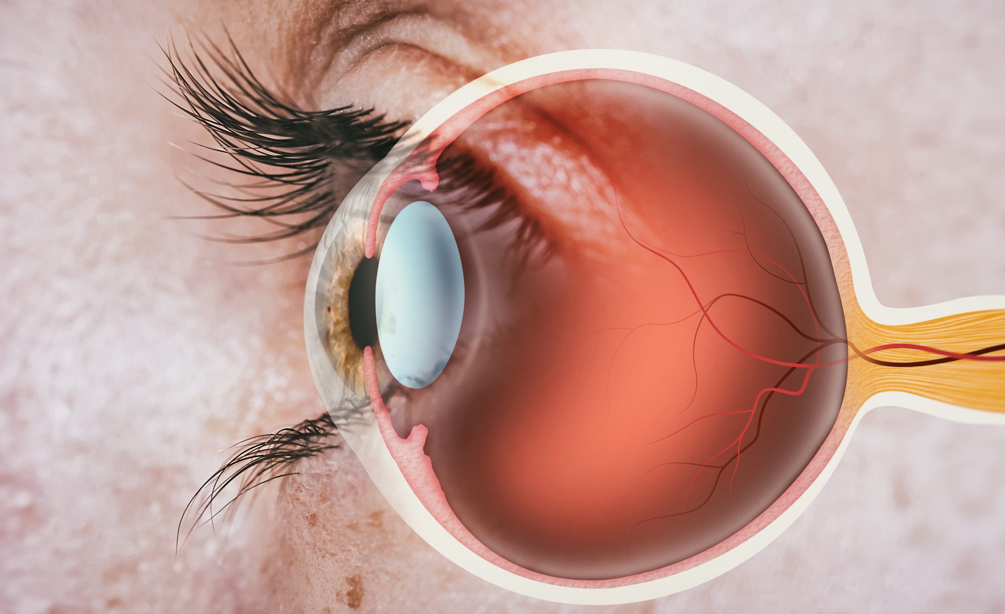 ¿Qué es un desprendimiento de retina? - APEC Blog
